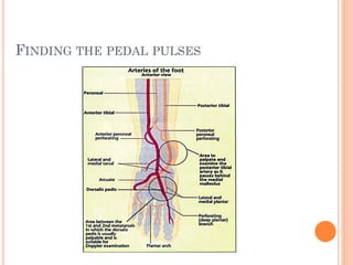 Pedal Pulses Diagram
