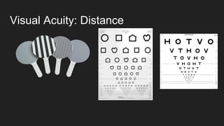 An-Overview-of-Assessment-Techniques-in-Low-Vision.pdf