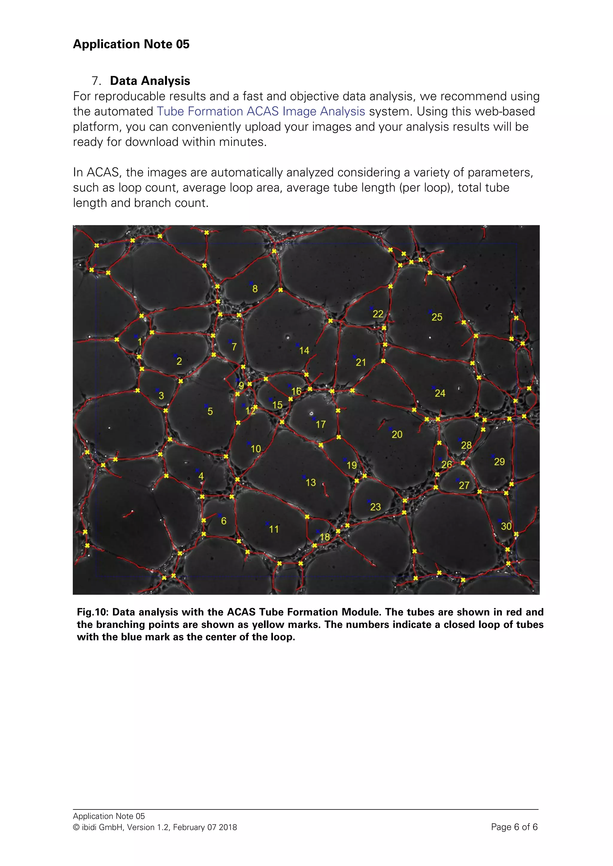 Tube formation Assays with the u-plate Angiogensis 96 well | PDF ...