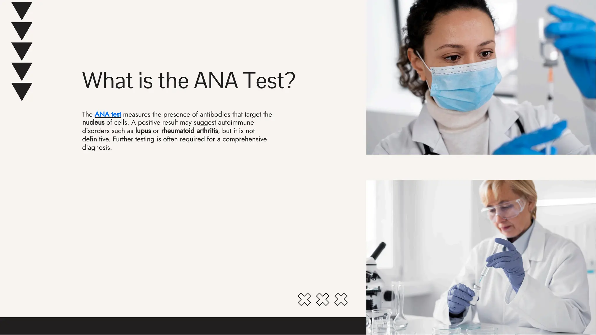 ANA (antinuclear antibody) test in Autoimmune Diagnose | PDF