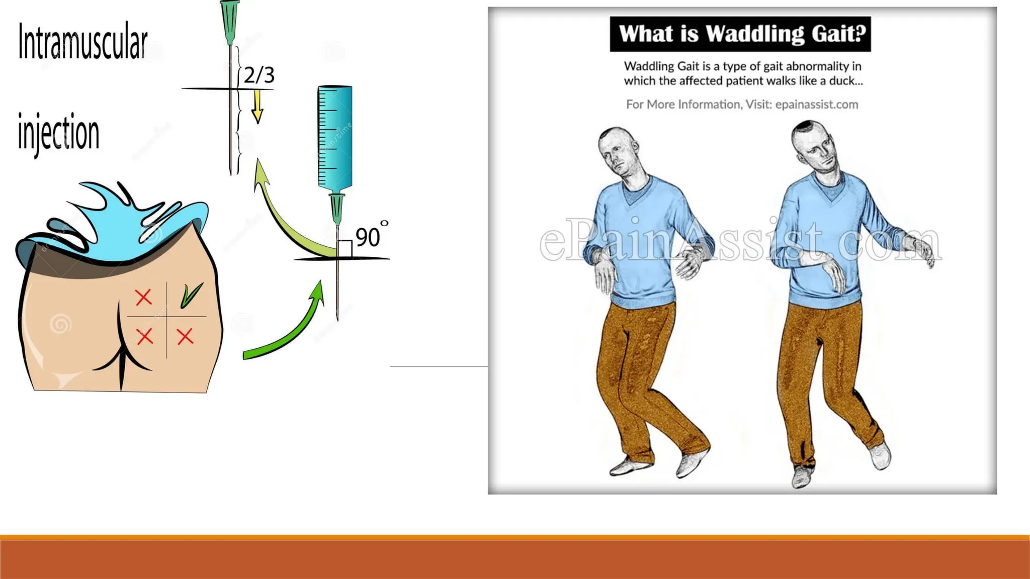 ANA 211 Gluteal region ror 200l health science students | PPTX