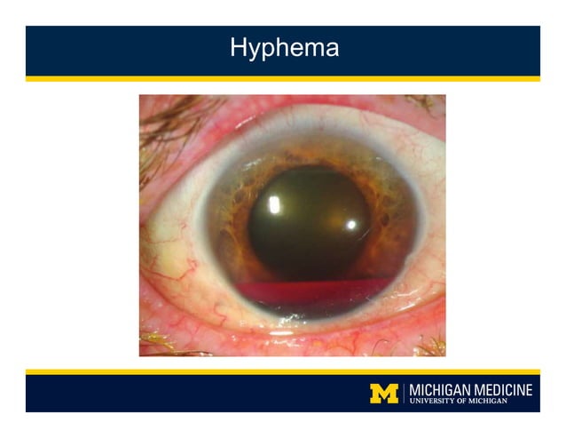 Anacker Michael On-Field Assessment & Management of Injuries 10-2.pdf