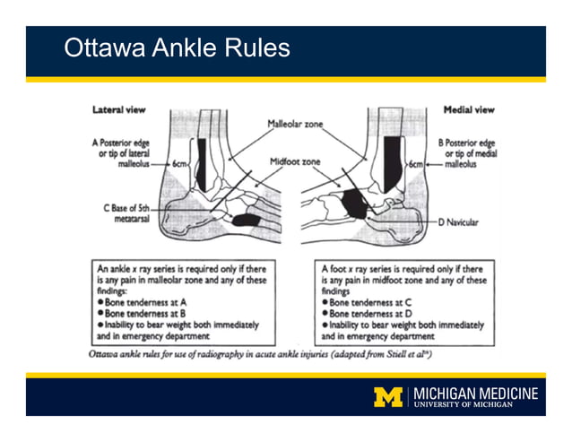 Anacker Michael On-Field Assessment & Management of Injuries 10-2.pdf