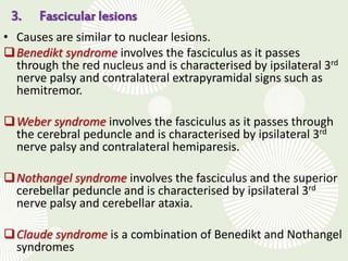 Anatomy of 3rd cranial nerve | PPTX