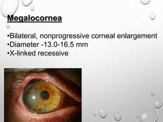 Anatomy of Cornea | PPT