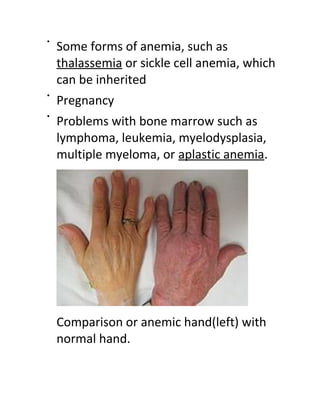 Anaemia | DOC