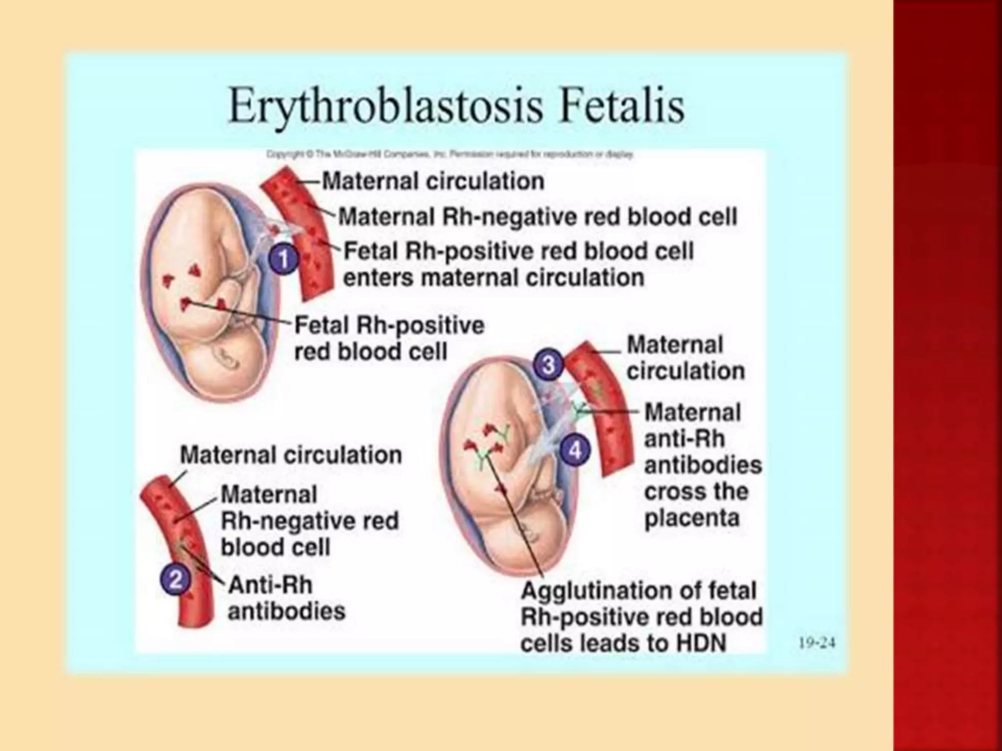 Anaemia- Classification, types, causes, pathophysiology, etiology | PPTX