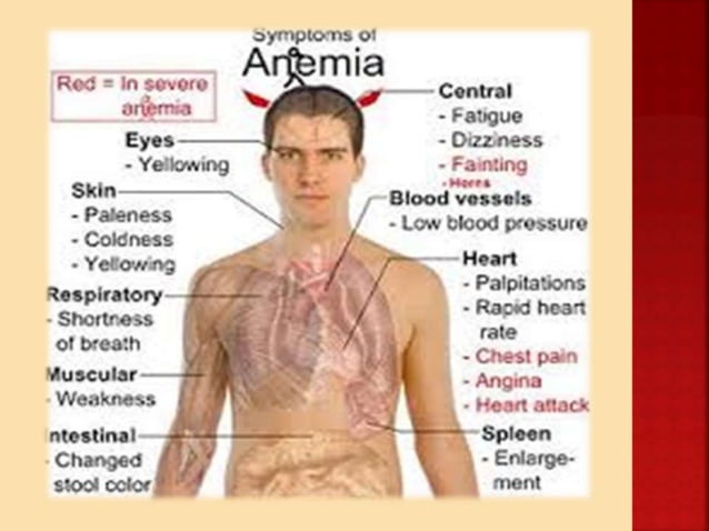 Anaemia- Classification, types, causes, pathophysiology, etiology ...