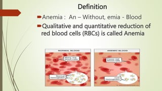 Anaemia. msn for bsc nursing students ss | PPTX | Blood Disorders ...