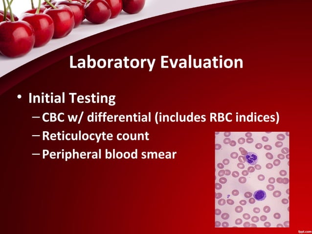 Understanding Iron Deficiency Anaemia (IDA) Lab Test & management with ...