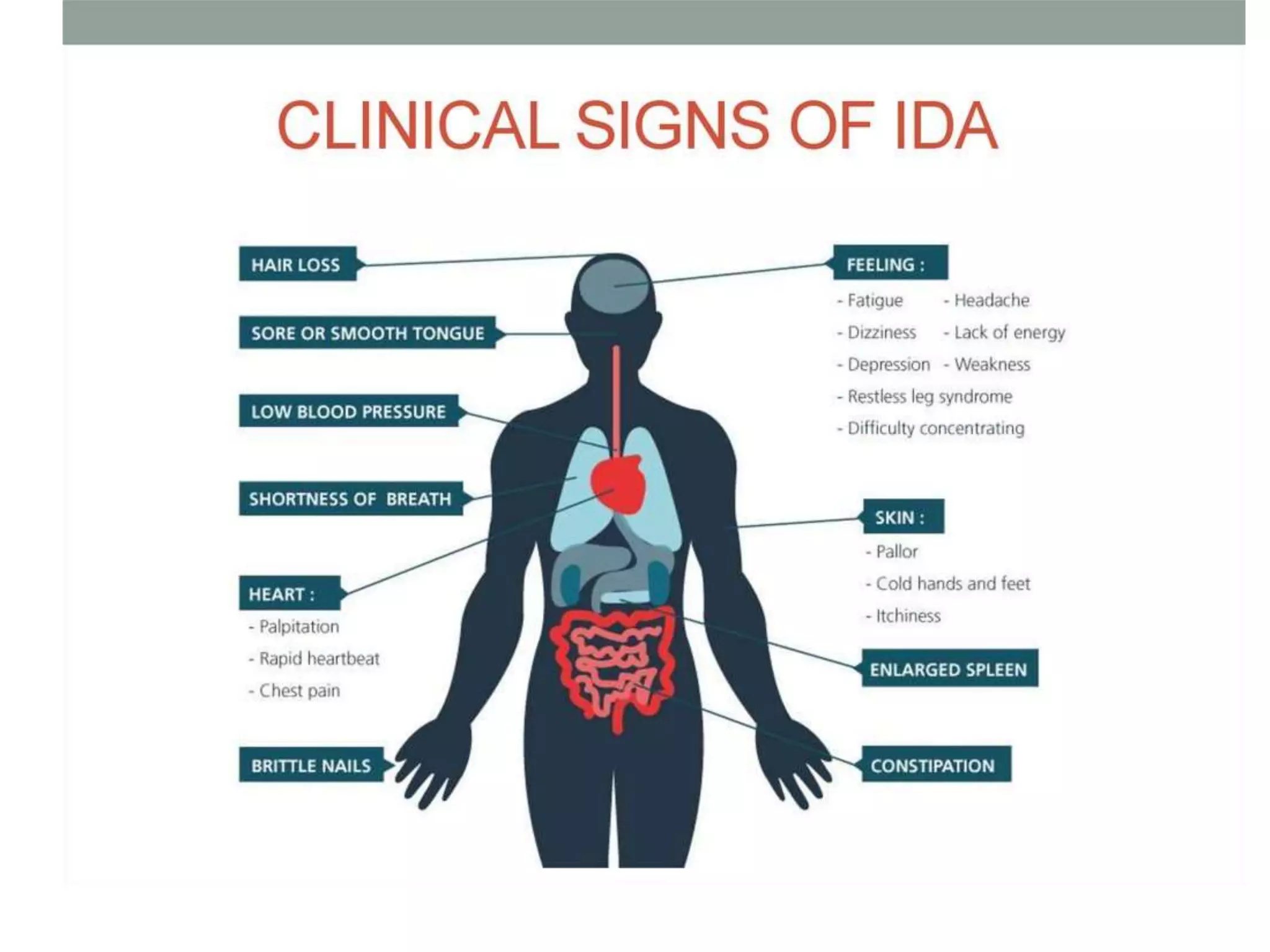 anaemia general, IDA.pptx | Blood Disorders | Diseases and Conditions