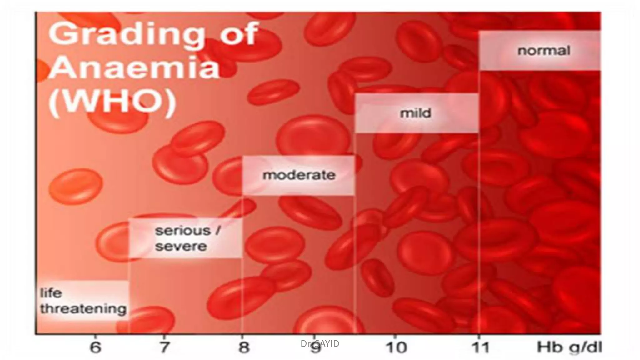 Anemia,classification of anaemia, Hb, RBC indicie | PPTX
