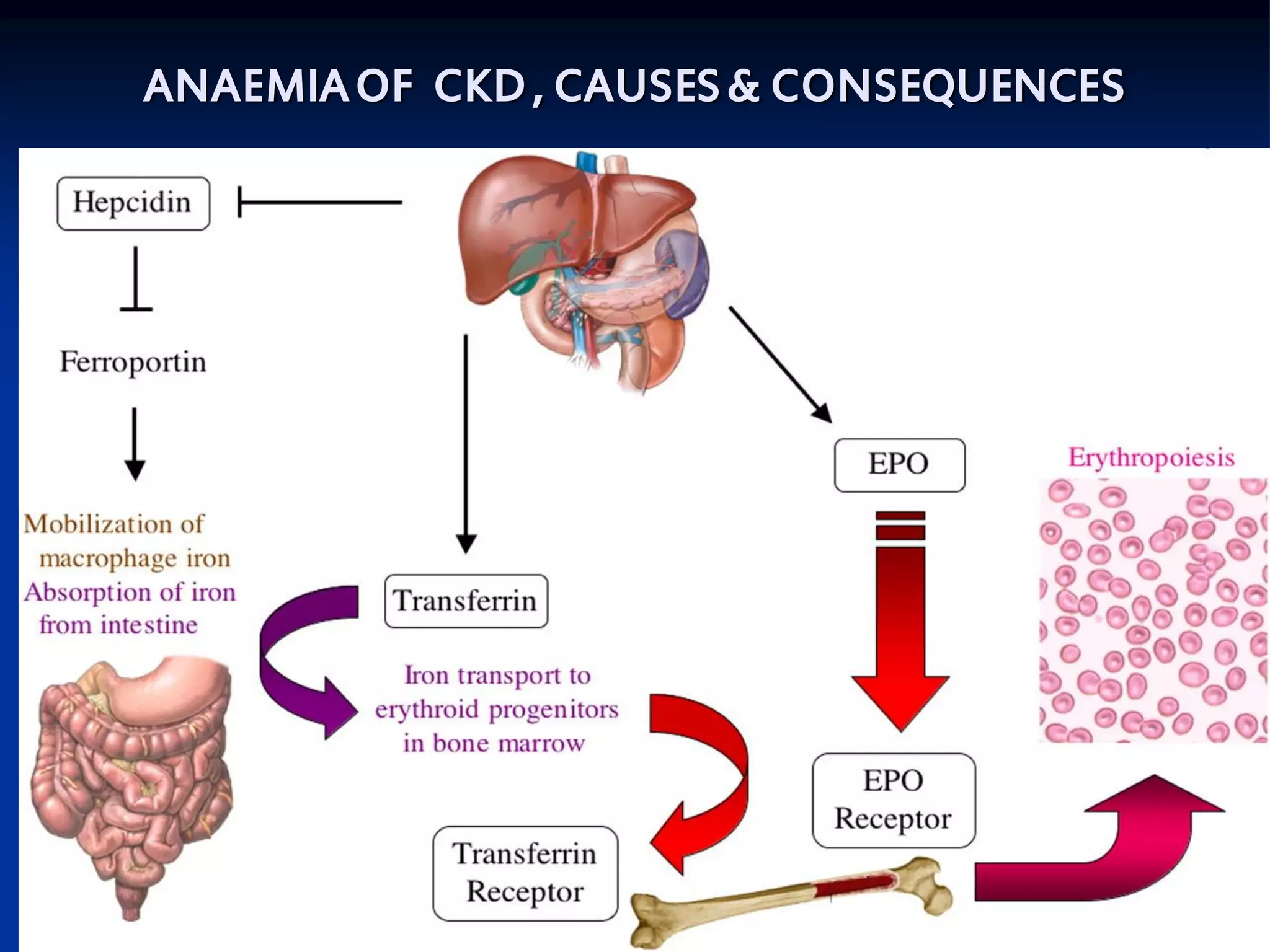 Anaemia of chronic kidney disease GUIDELINES TO PRACTICE 2013 | PDF