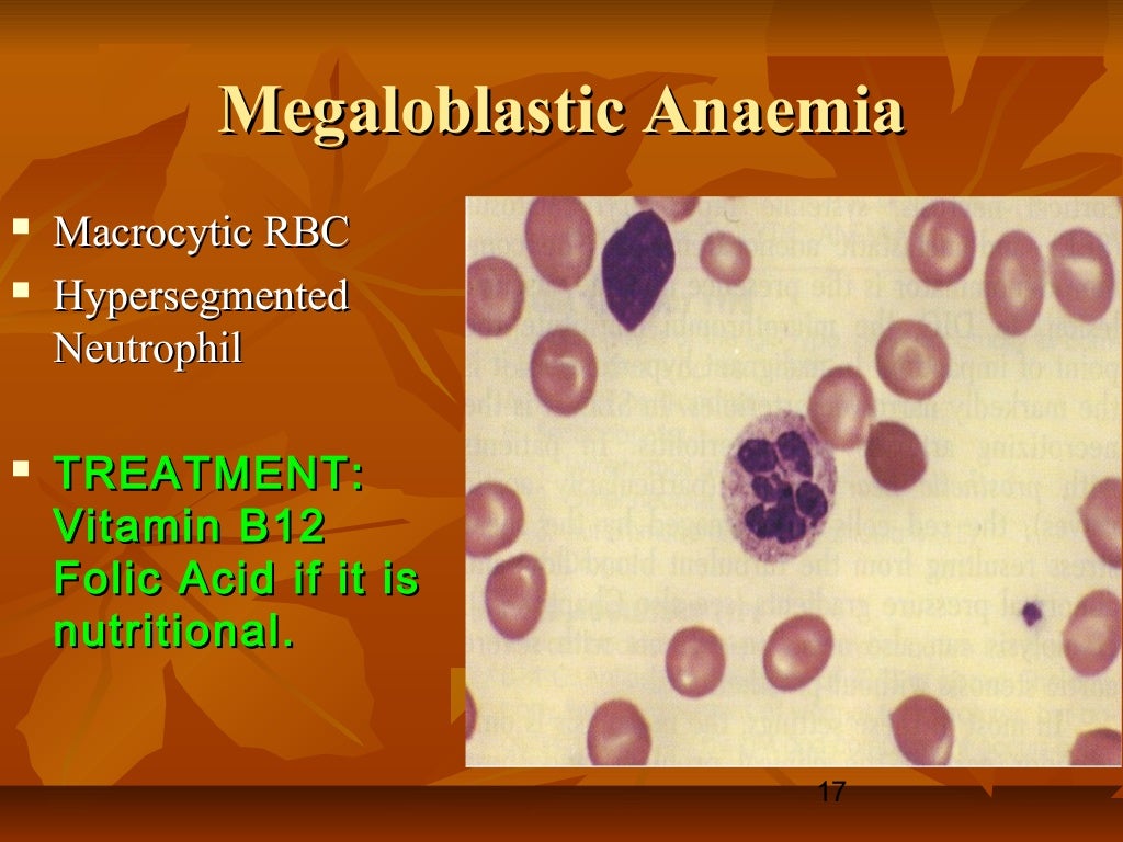 Anemia PPT
