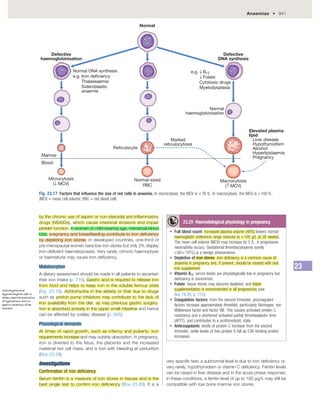 types of anemia: - Iron Deficiency Anemia (IDA) - Anemia of Chronic ...