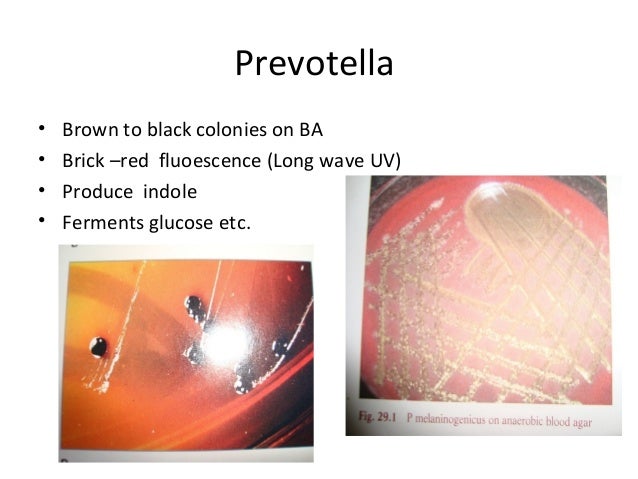 Anaerobic bacteria