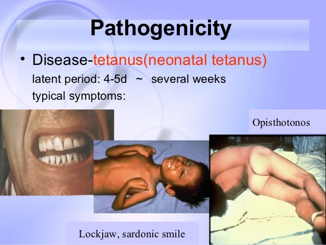 Anaerobic bacteria spring 2011