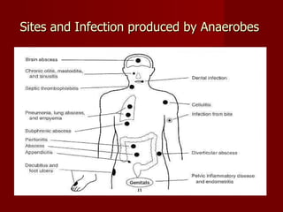 Anaerobic Bacteriology Lecture | PPT