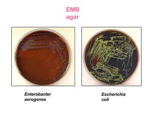 Enterobacter Cloacae Emb