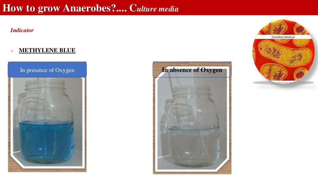 Anaerobic Culture Media And Methods anaerobic-culture-media-and-methods