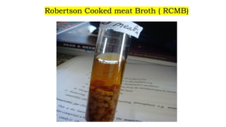 Anaerobic Culture methods of bacteria.pdf