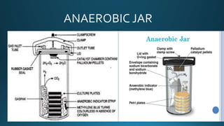 Anaerobic jar | PPT