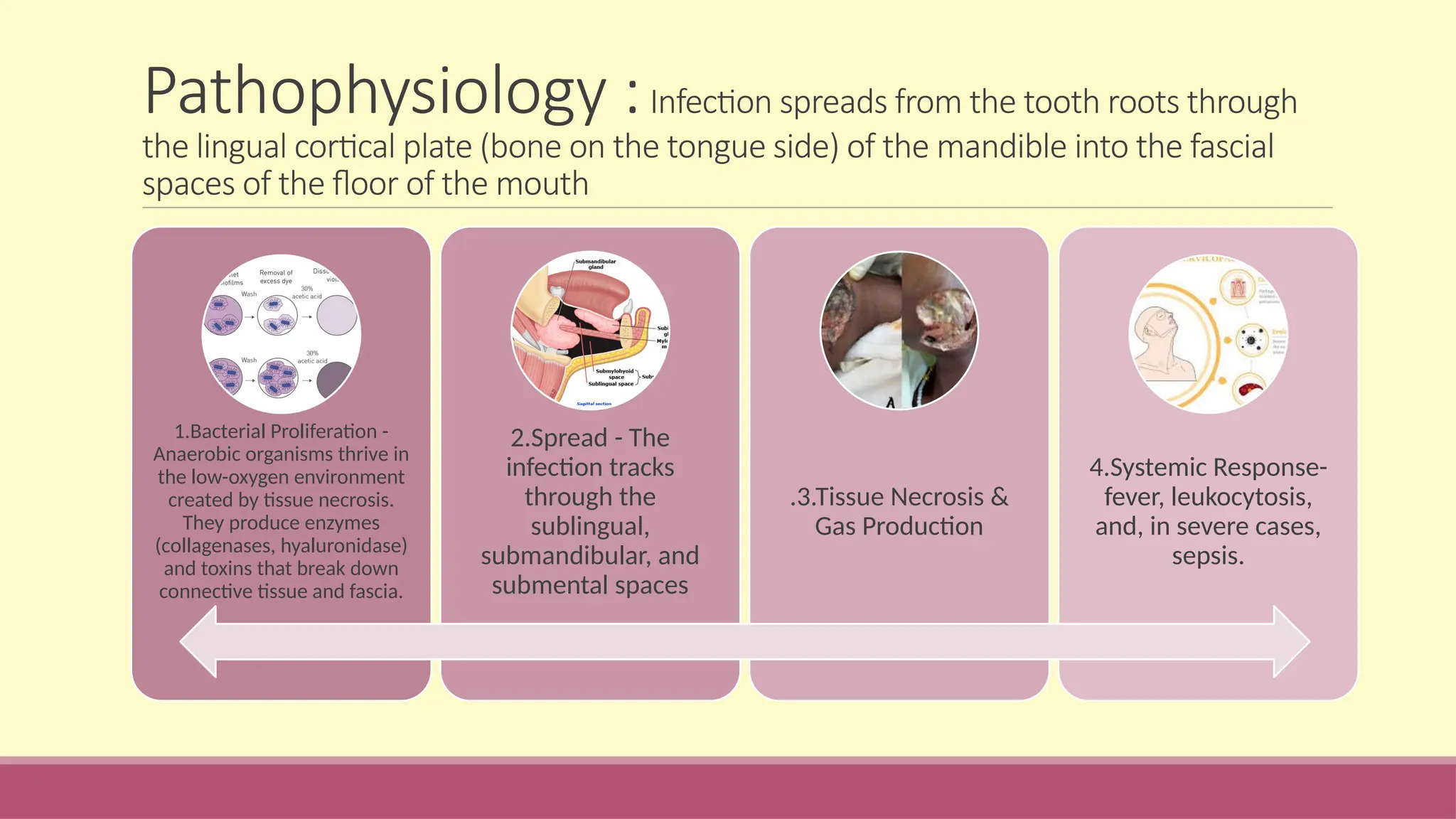 anaerobic phlegmon of floor of oral cavity | PPTX