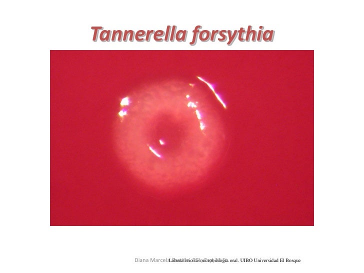 Tannerella forsythia - Alchetron, The Free Social Encyclopedia