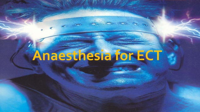 Anaesthesia for MRI, ECT, Cardioversion | PPTX