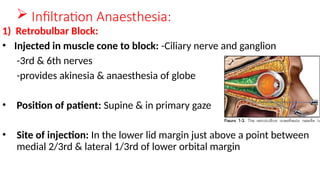 Ocular Anaesthesia by Sachin Mahatra.pptx