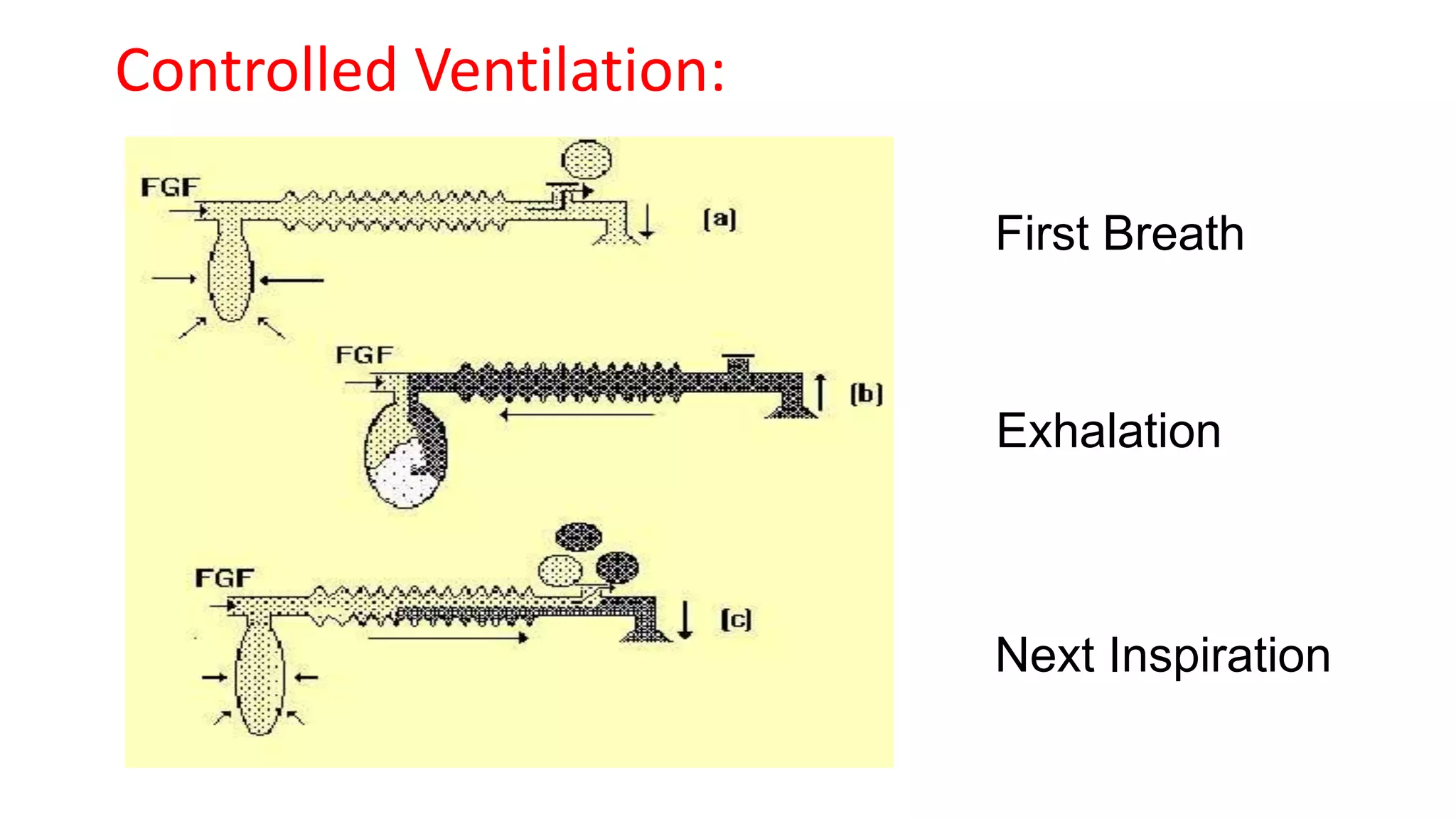 Anaesthesia breathing systems | PPTX