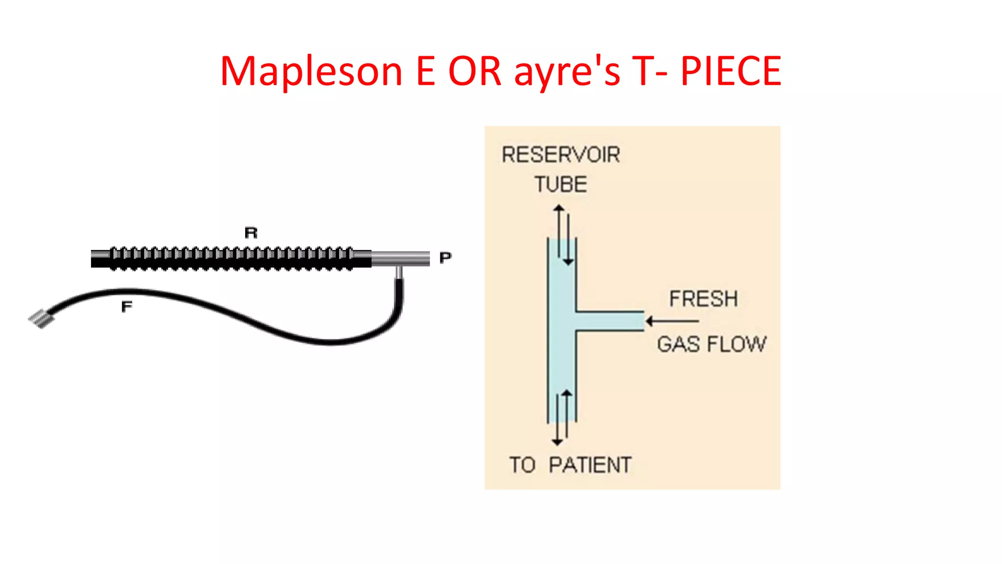 Anaesthesia breathing systems | PPTX
