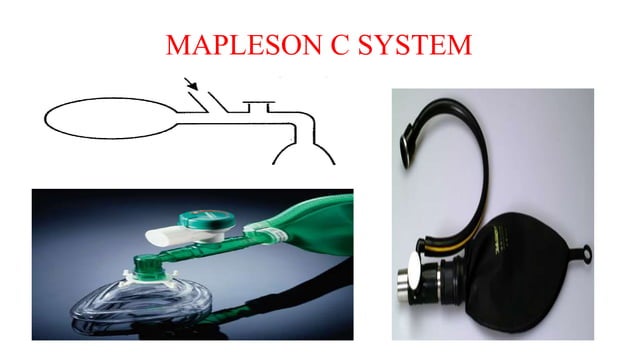 Anaesthesia breathing systems | PPTX