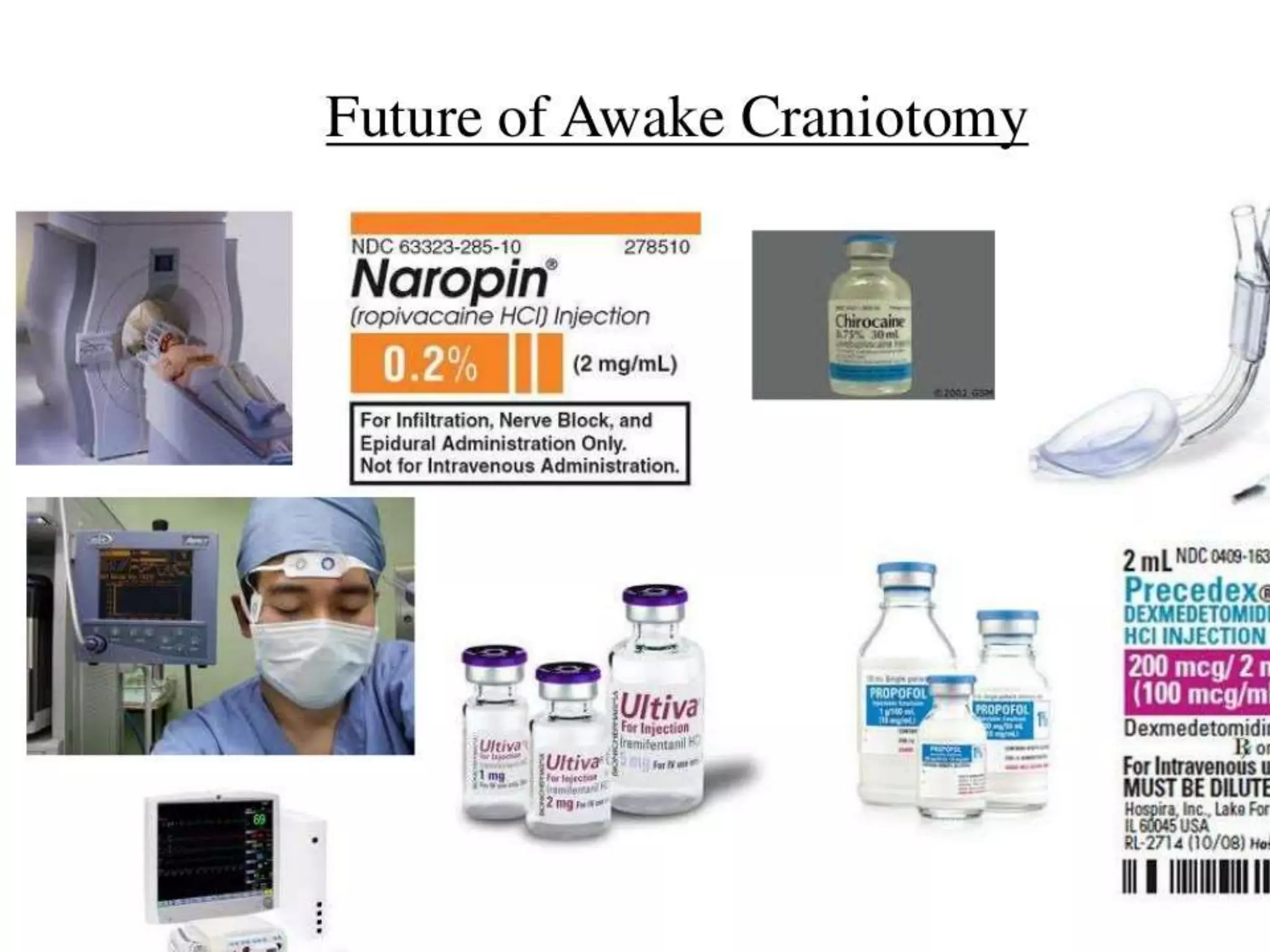 ANAESTHESIA FOR AWAKE CRANIOTOMY | PPTX