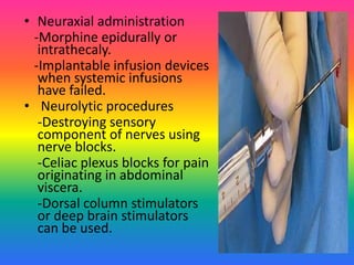Anaesthesia for cancer patients | PPTX