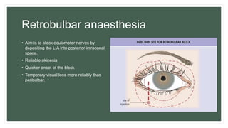 Anaesthesia for cataract surgery | PPTX