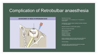 Anaesthesia for cataract surgery | PPTX