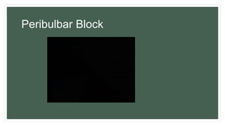 Anaesthesia for cataract surgery | PPTX