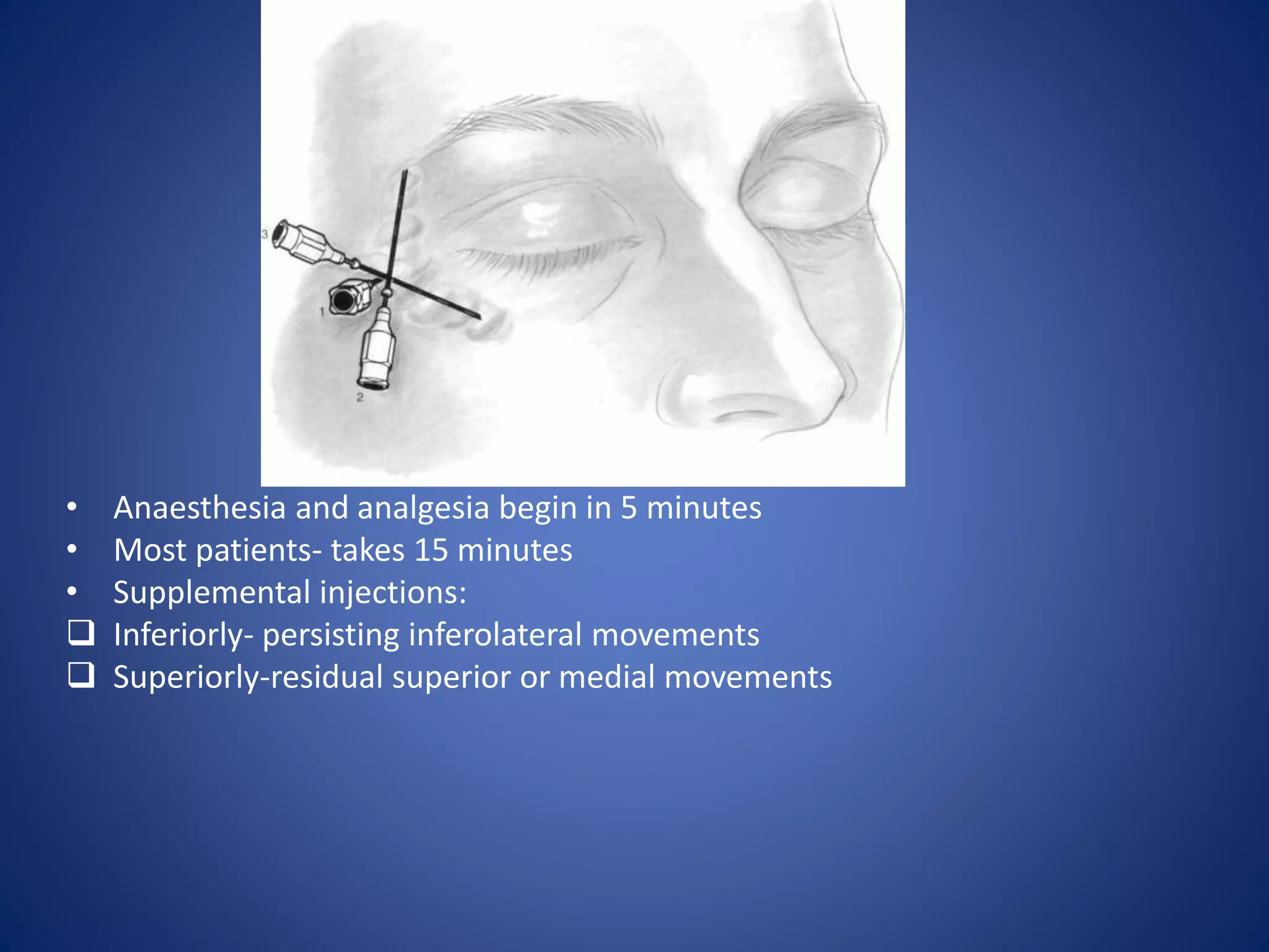 Anaesthesia for cataract surgery | PPTX