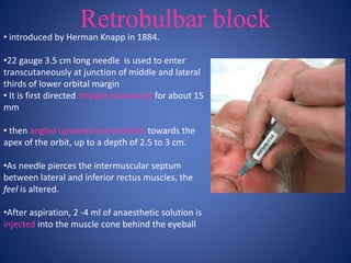 Anaesthesia for cataract surgery | PPTX