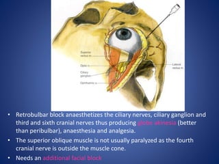 Anaesthesia for cataract surgery | PPTX