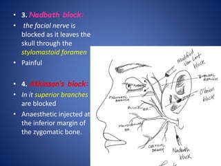 Anaesthesia for cataract surgery | PPTX