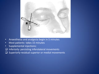 Anaesthesia for cataract surgery | PPTX