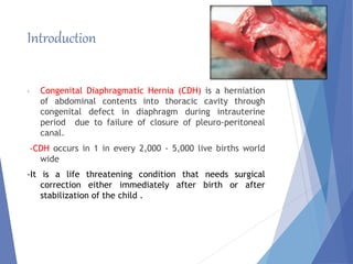 Anaesthesia for cdh | PPTX