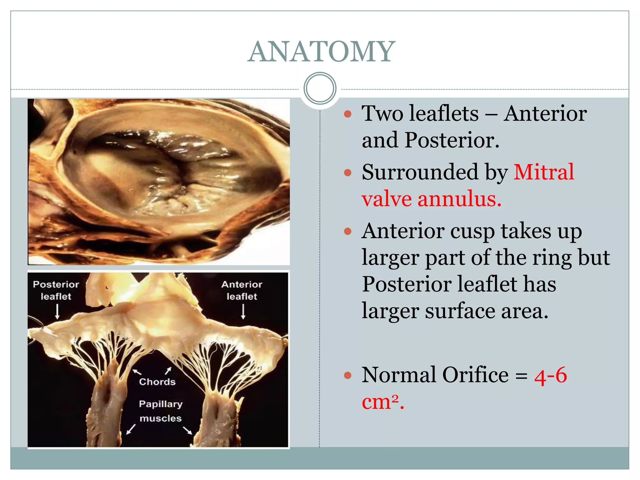 Anaesthesia for closed mitral valvotomy | PPTX