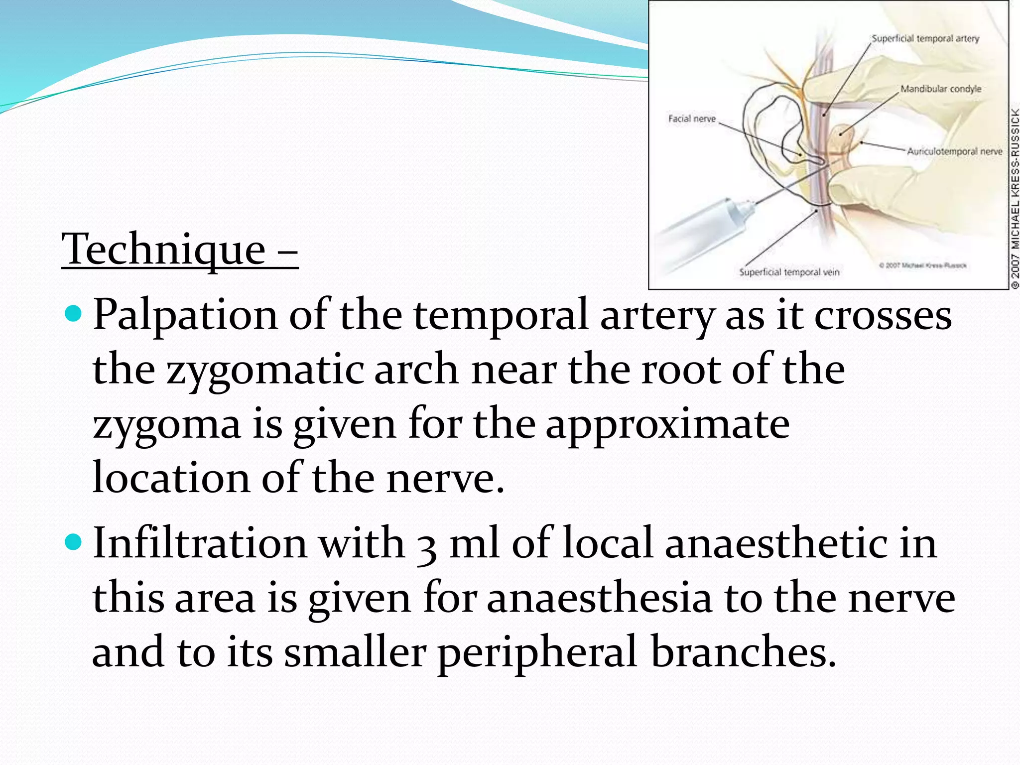 Anaesthesia for ear sugery | PPTX