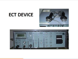 Anaesthesia for ELECTROCONVULSIVE THERAPY/ECT | PPT