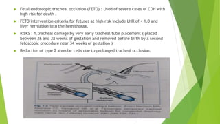 anaesthesia for fetal surgery.pptx