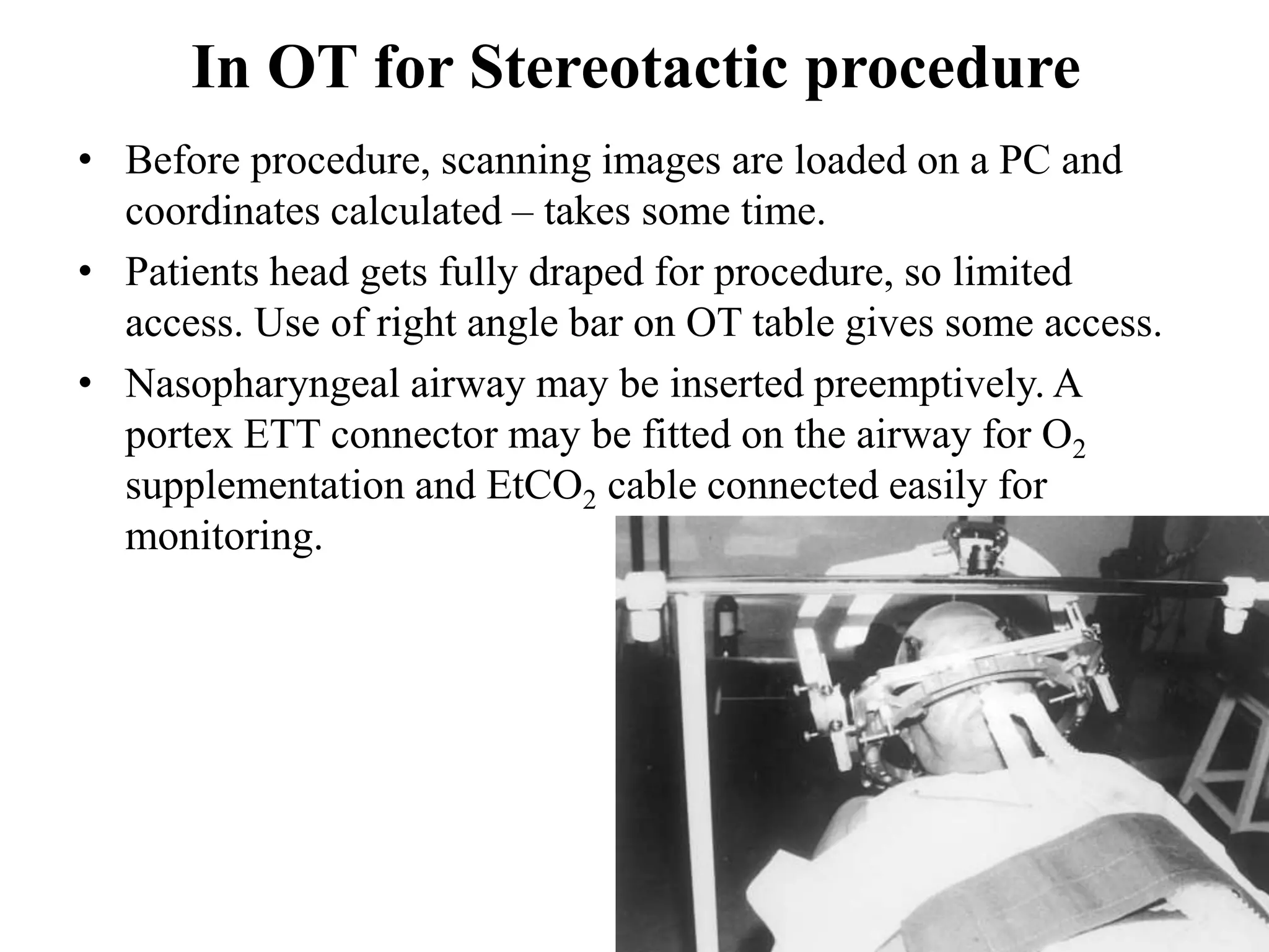 Anaesthesia for functional neurosurgery | PPTX