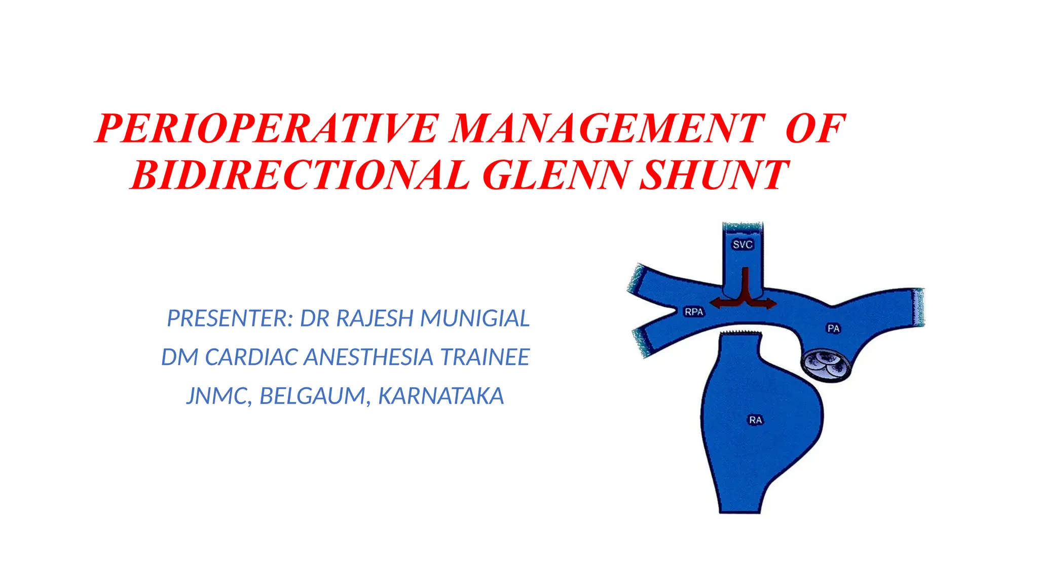 perioeperative anesthesia management of bidrectional glenn | PPTX